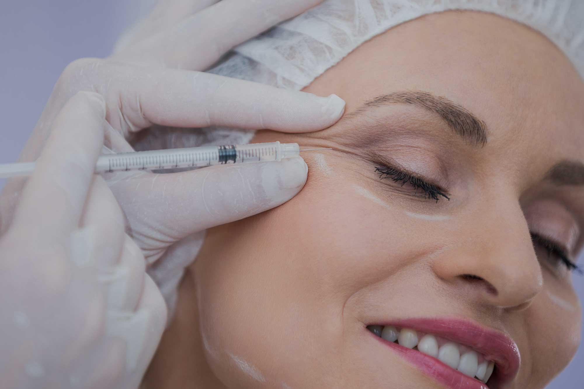 Botox Full Face | Mya Clínica